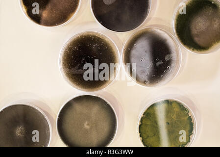blood agar culture plate growing Bacillus anthracis (anthrax Stock ...