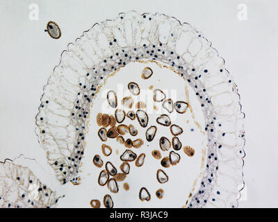 Light photomicrograph of Lily anther cross section seen through ...