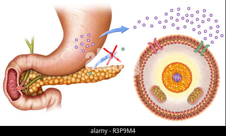 Illustration of insulin and glucose production in Type 2 diabetes ...