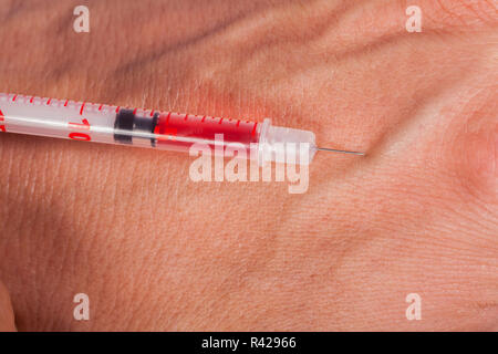 small syringe with needle in the skin Stock Photo - Alamy