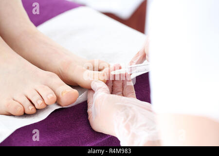 Analgesic injection. Surgical removal of ingrown nail. Injection on the ...