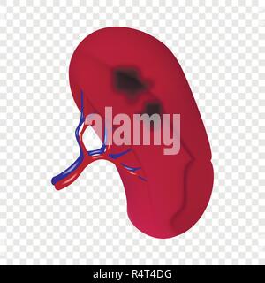 Black disease of spleen icon. Realistic illustration of black disease ...