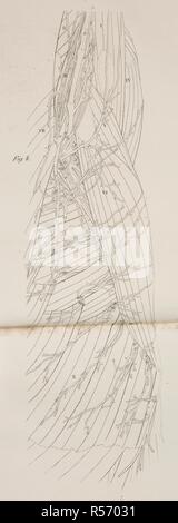 Anatomical drawing, Muscular system, Anatomical print of the human body ...