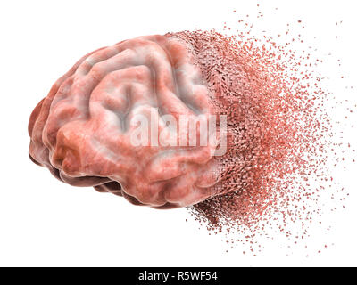 Traumatic brain injury, illustration Stock Photo - Alamy