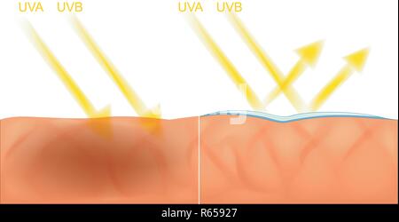 uv ray from sun penetrate into epidermis of skin cross-section of human ...