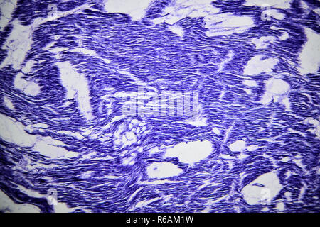 Human Heart Muscle Under Microscope Stock Photo - Alamy