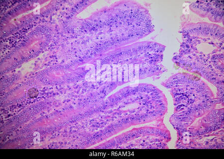 Human Intestinal Wall Under Microscope Stock Photo - Alamy