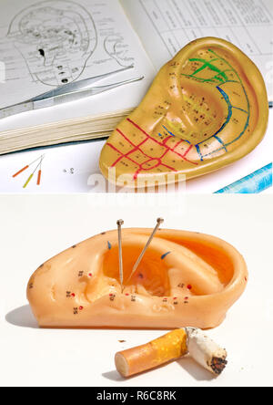 Acupuncture To Stop Smoking, Cigarette, Needle, Model And Textbook ...