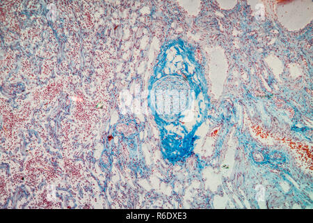 Lymph node under the microscope Stock Photo - Alamy