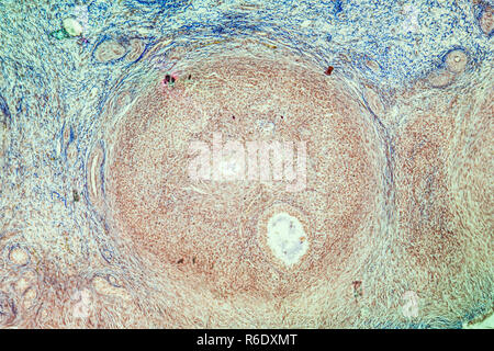 Ovary tissue under the microscope Stock Photo - Alamy