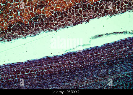 pine embryo with endosperm across 100x Stock Photo - Alamy