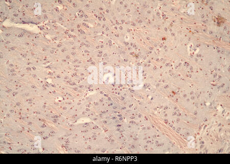 Brain cells tissue under the microscope 100x Stock Photo - Alamy