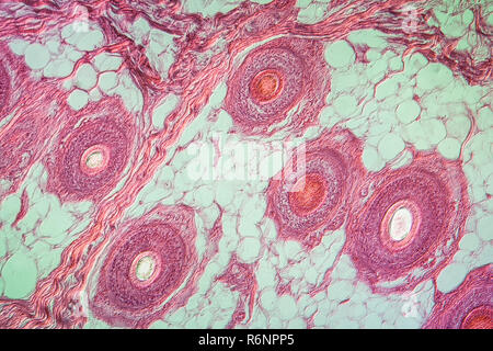 scalp under the microscope Stock Photo - Alamy