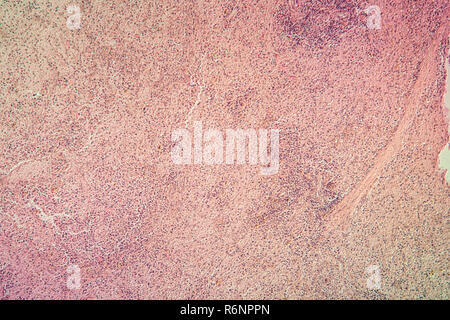 heart calluses under the microscope Stock Photo - Alamy
