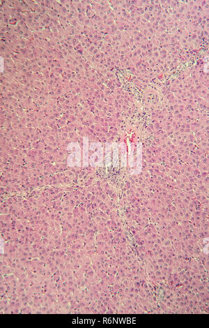 pig liver under the microscope Stock Photo - Alamy