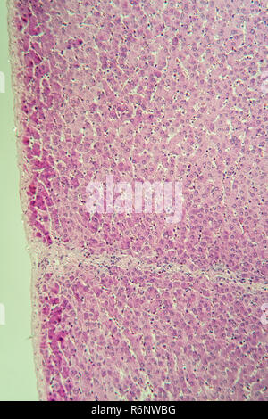 pig liver under the microscope Stock Photo - Alamy