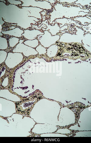Asthma lung tissue under the microscope 100x Stock Photo - Alamy