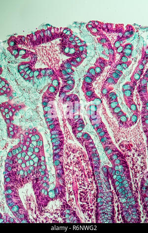 small intestine under the microscope Stock Photo - Alamy