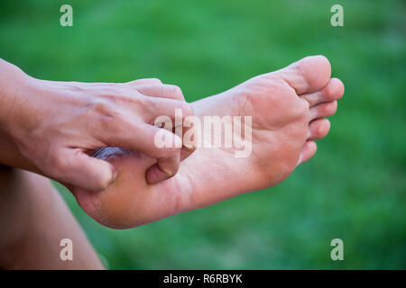 Close up a woman with itchy feet uses his big toe to scratch his other ...