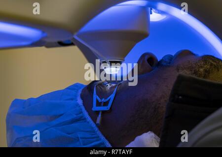 SAN DIEGO (April 6, 2017) A patient has his eyes checked after ...