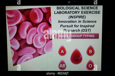 Procedure - Blood typing Stock Photo - Alamy