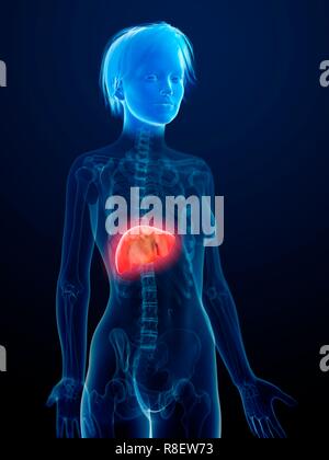 Inflamed liver, illustration Stock Photo - Alamy