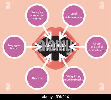 Human healthy muscle nerves Stock Vector Image & Art - Alamy