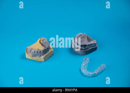 Molds of the jaw. dental splint. Dental implants on blue background ...