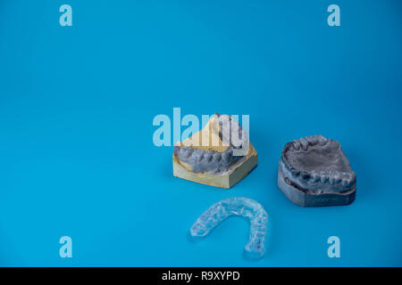 Molds of the jaw. dental splint. Dental implants on blue background ...