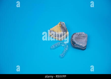 Molds of the jaw. dental splint. Dental implants on blue background ...
