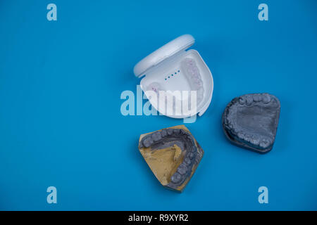 Molds of the jaw. dental splint. Dental implants on blue background ...