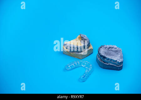 Molds of the jaw. dental splint. Dental implants on blue background ...