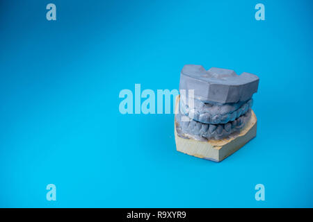 Molds of the jaw. dental splint. Dental implants on blue background ...