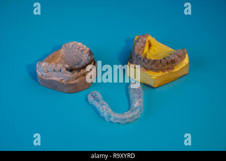 Molds of the jaw. dental splint. Dental implants on blue background ...