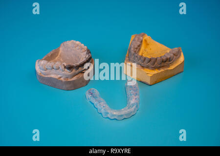 Molds of the jaw. dental splint. Dental implants on blue background ...