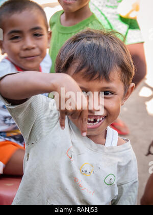 A young boy without his two front teeth Stock Photo - Alamy