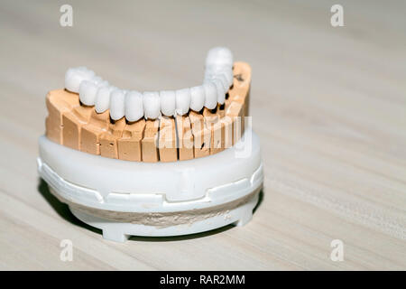 Close-up of a metal plate in the mouth on the teeth of a little boy ...