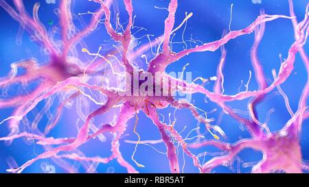 Illustration of a nerve cell (neuron) with a damaged myelin sheath ...