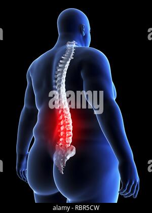 Illustration of an obese man having back pain Stock Photo - Alamy
