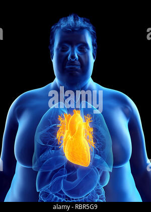 Illustration of an obese man's heart Stock Photo - Alamy