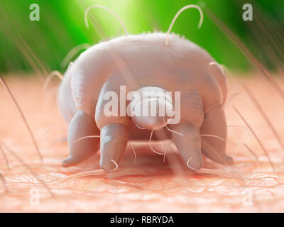 Scabies mite on human skin, illustration Stock Photo - Alamy