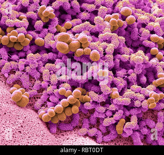 Foot bacteria. Scanning electron micrograph (SEM) of bacteria that live ...