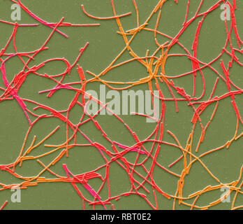 Anthrax bacteria. Coloured scanning electron micrograph (SEM) of ...
