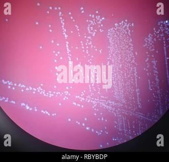 Aerococcus urinae colonies Stock Photo - Alamy