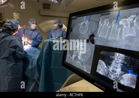 A modern operating room, surgeons and doctors doing an oncological ...