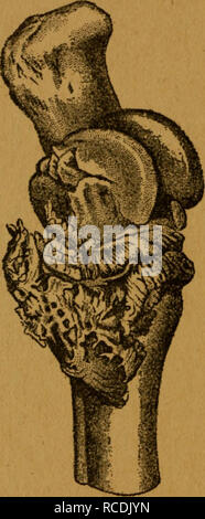 . PLATE SHOWING SITUATION OF BONE- SPAVIN. we find it on working oxen ...