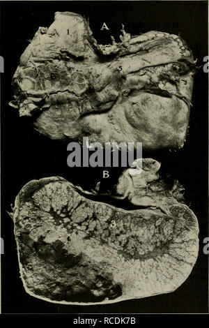 . Fig. 215—Tuberculosis of Testis. Boar. A, Median section ; B ...