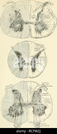Spinal cord, anterior side showing grey and white matter ...