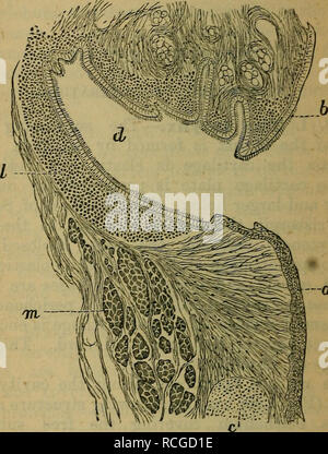 VOCAL CORD NODULE Stock Photo - Alamy