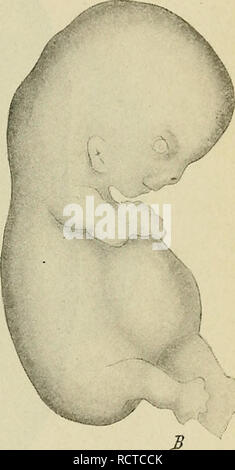 Human Embryo 7 mm. long, Showing the Umbilical Region Stock Photo - Alamy